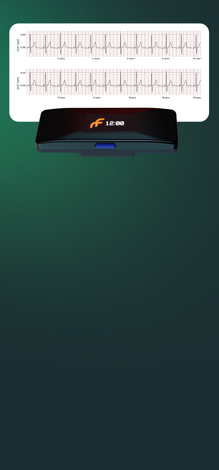 The Power Of 24 Hours Continuous ECG | Frontier X2