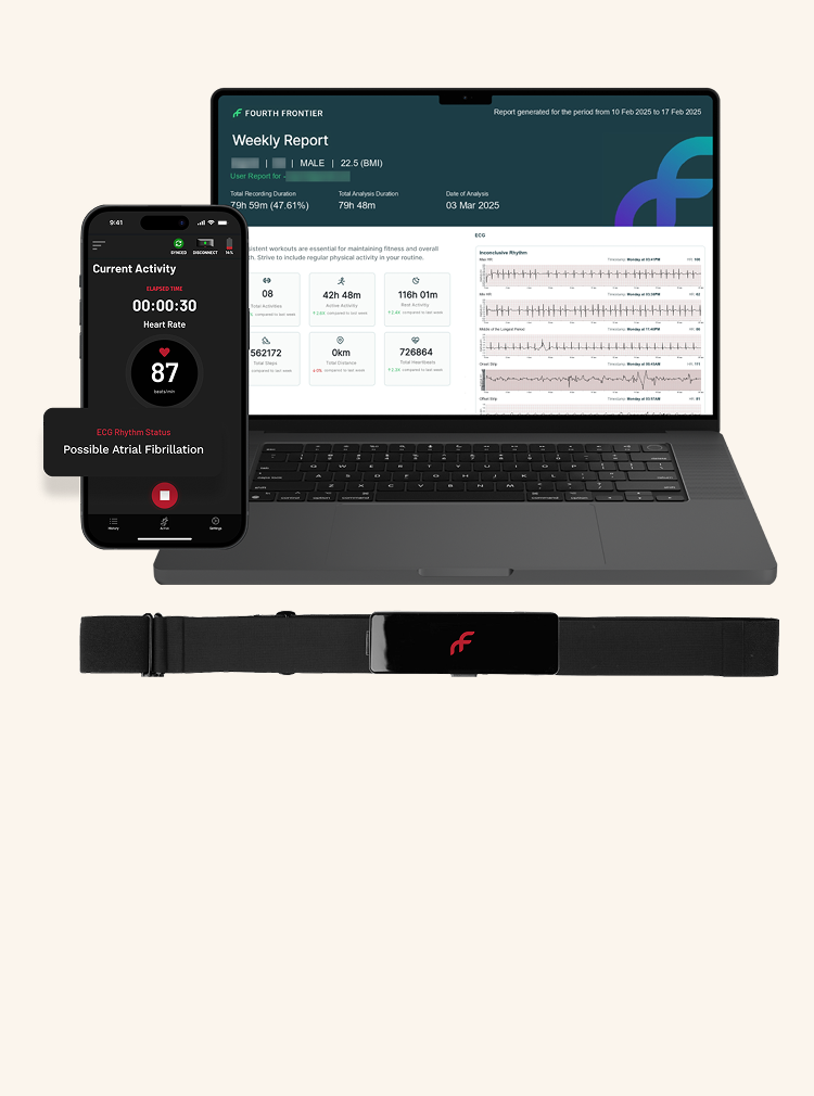Frontier X Plus | Weekly Cardiac Rhythm Report for Arrhythmia Analysis
