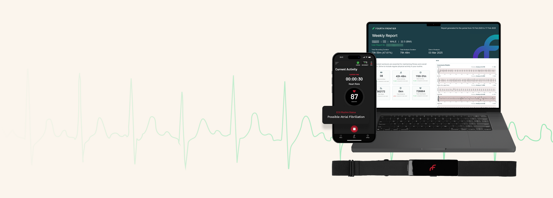 Frontier X Plus | Weekly Cardiac Rhythm Report for Arrhythmia Analysis